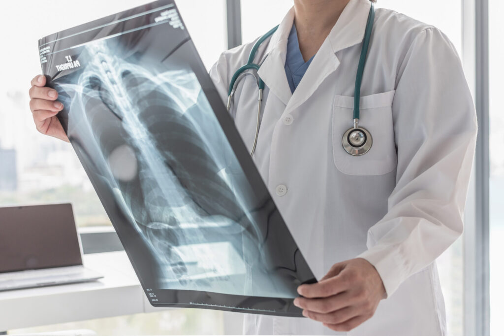 Symptoms Of A Broken Tailbone | Chicago, IL | Zayed Law Offices ...