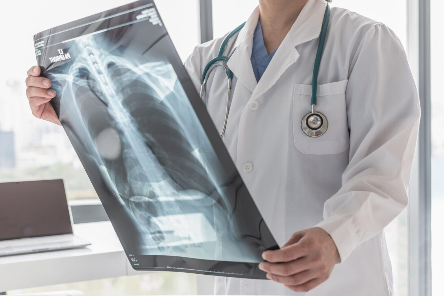 Symptoms Of A Broken Tailbone | Chicago, IL | Zayed Law Offices ...